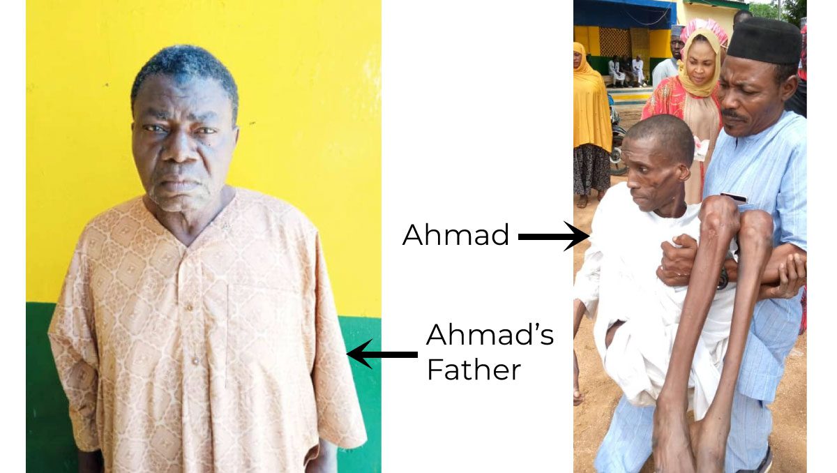Story Of Ahmad, The 30-Year-Old Man Locked Up By Parents For 7 Years ...