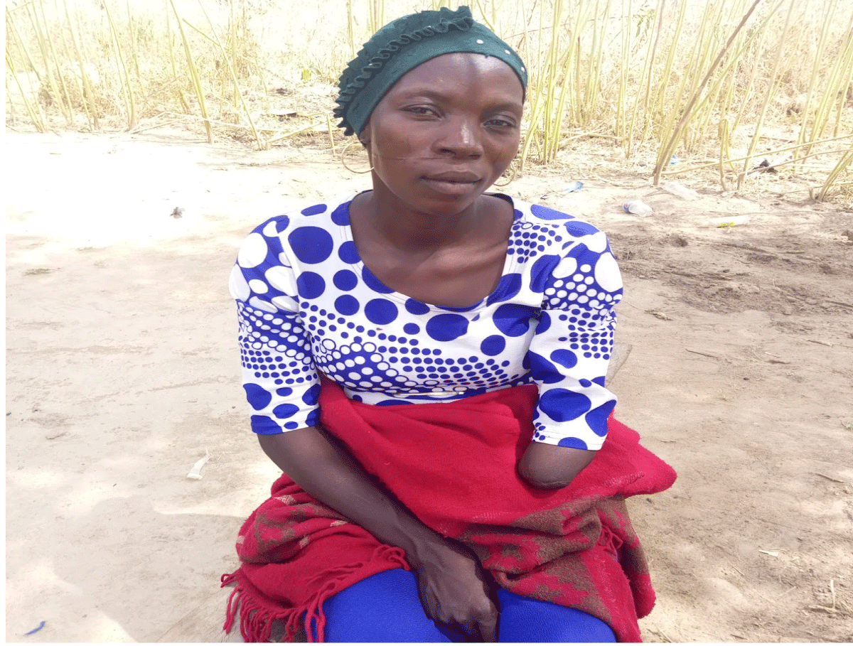 'I Lost My Right Arm And Three Children' - HumAngle