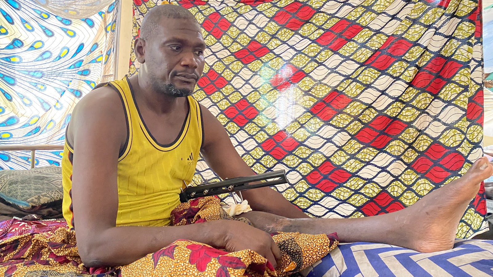 Survivors Of Deadly Attacks In Borno Left With Gruesome Injuries - HumAngle